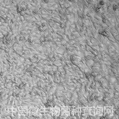 大鼠视网膜前体细胞R28_细胞CELL_biobw自建细胞系_微生物菌种查询网-ATCC,菌种,质粒,细胞系